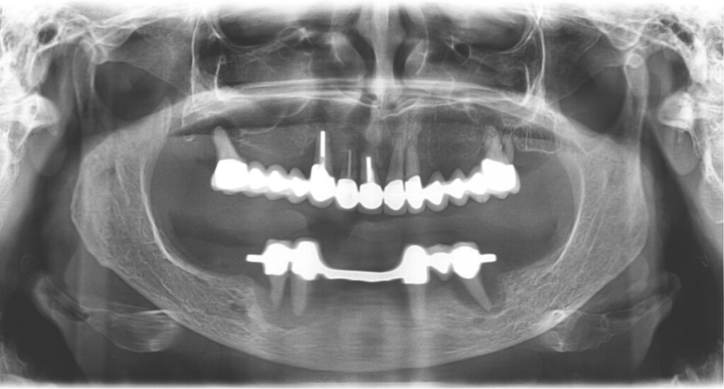 Parodontitistherapie - Prof. Dr. Michael Korsch